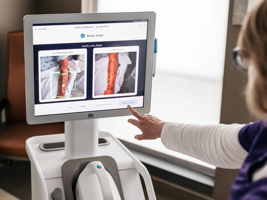 Wound Care Solutions for Predictive Healing | Spectral AI