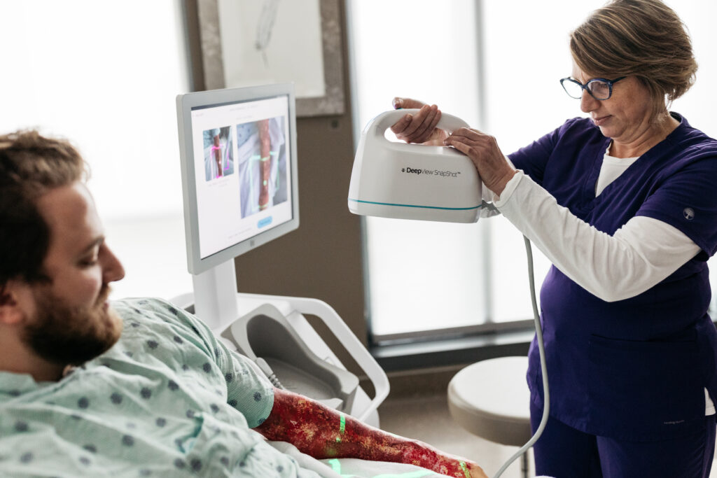 AI-based burn injury assessment could relieve patient suffering