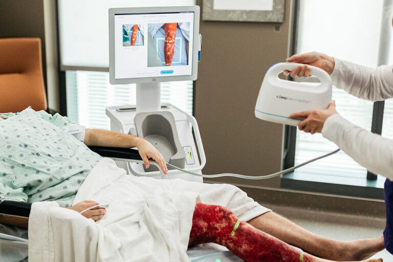 Deep Full Thickness Burn Diagnosis: Full Thickness Burns